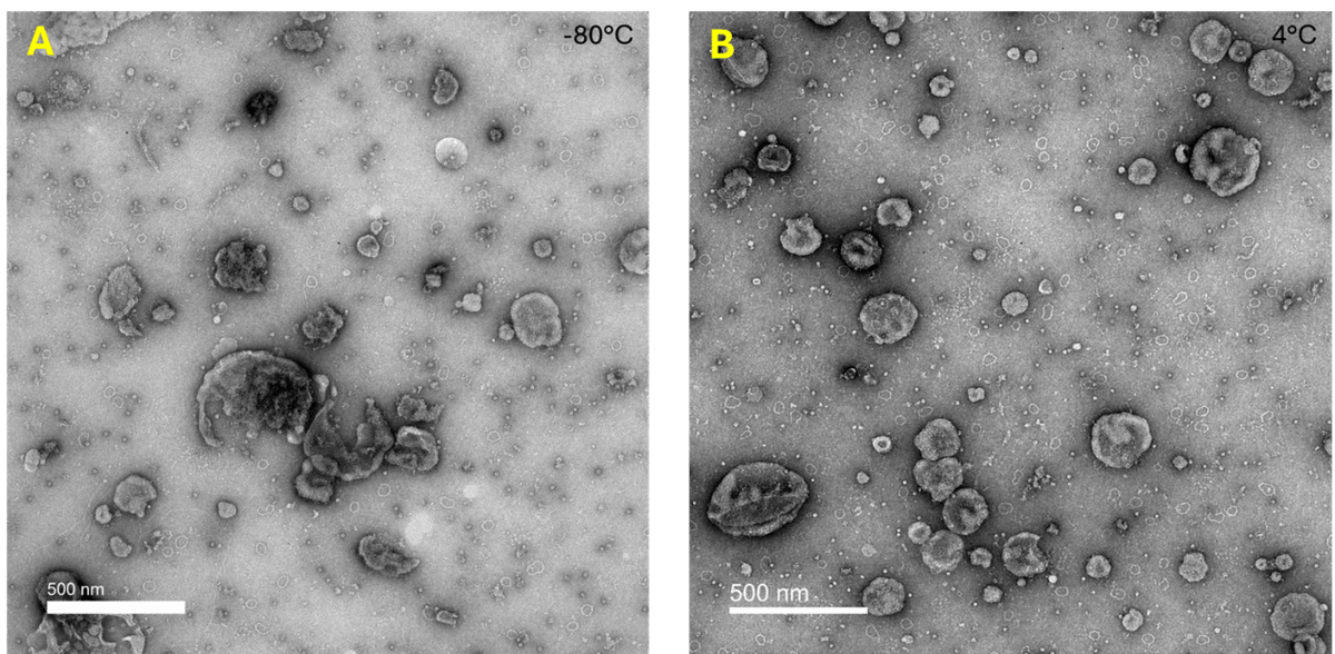 The Microscopic World of EVs - What TEM Can Tell You